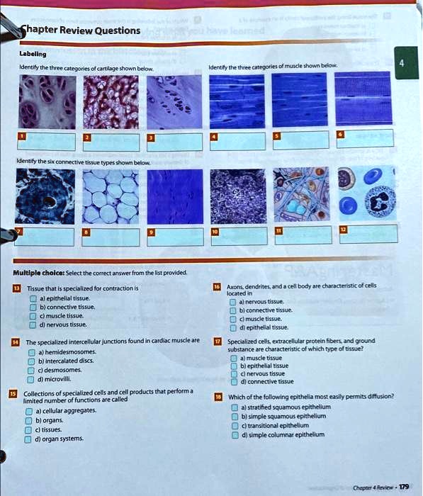 SOLVED: Texts: Shapter Review Questions Labeling: Identify the three categories of muscle shown ...