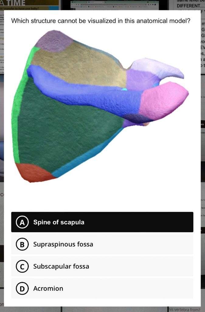 SOLVED: Which structure cannot be visualized in this anatomical model? Spine of scapula ...
