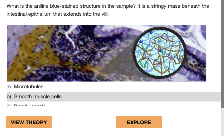 what is the aniline blue stained structure in the sample it is a ...