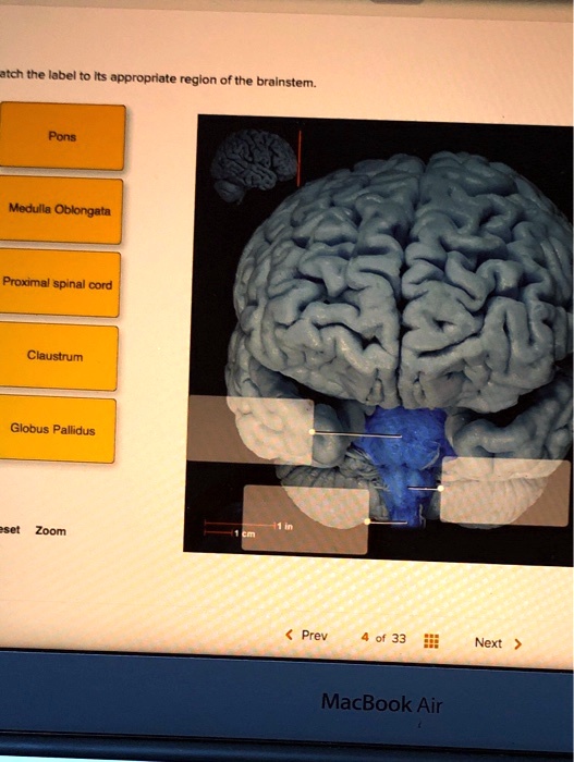 SOLVED: Match the label to its appropriate region of the brainstem ...