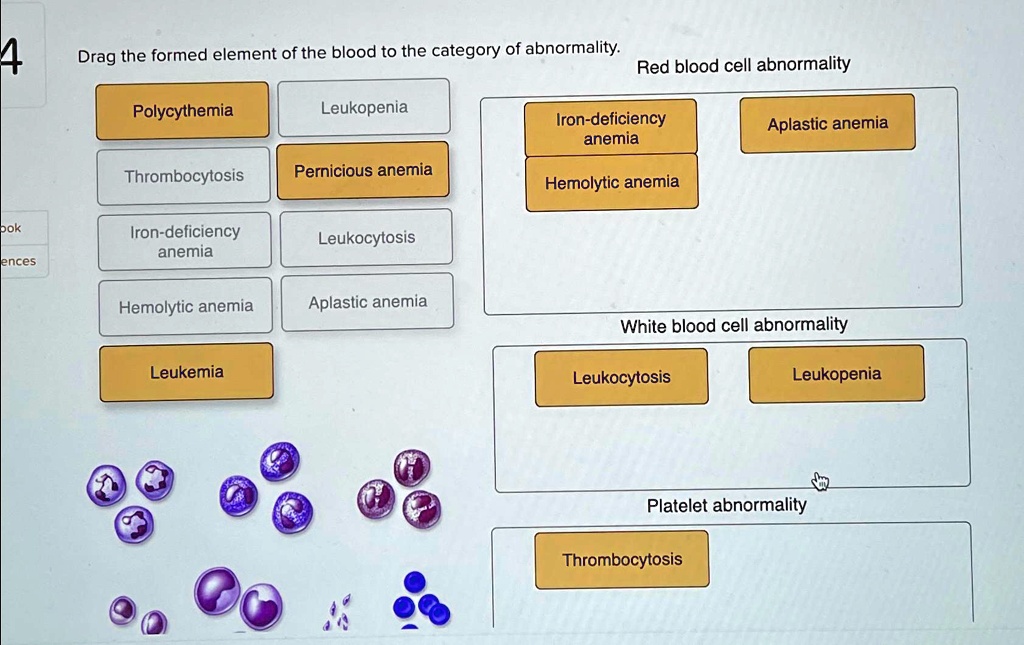 4 Drag the formed element of the blood to the category of abnormality ...