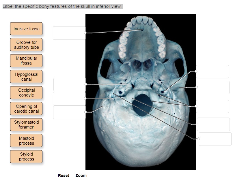 Label the specific bony features of the skull in inferior view ...