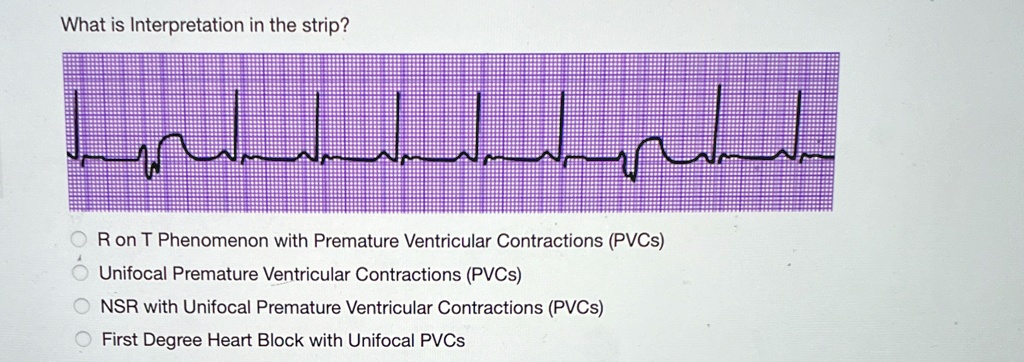 what is interpretation in the strip r on t phenomenon with premature ...