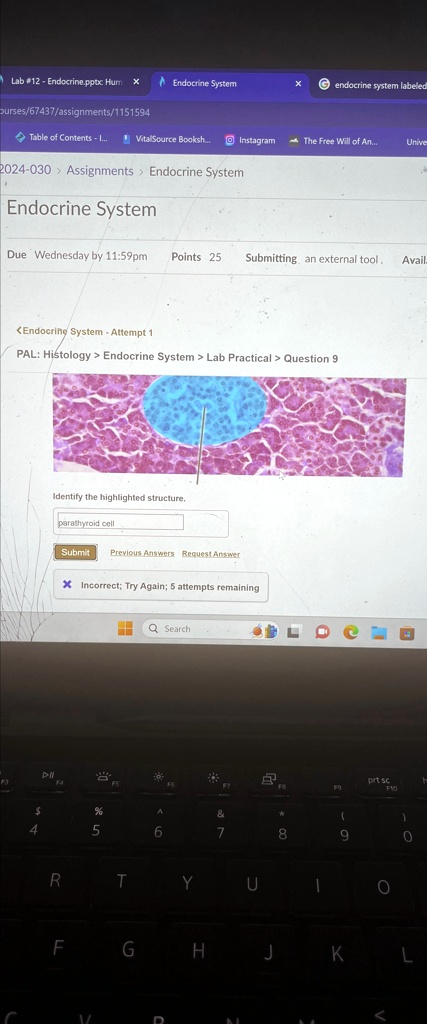 Lab #12 - Endocrine.pptx: Hum ourses/67437/assignments/1151594 Endocrine System endocrine system ...