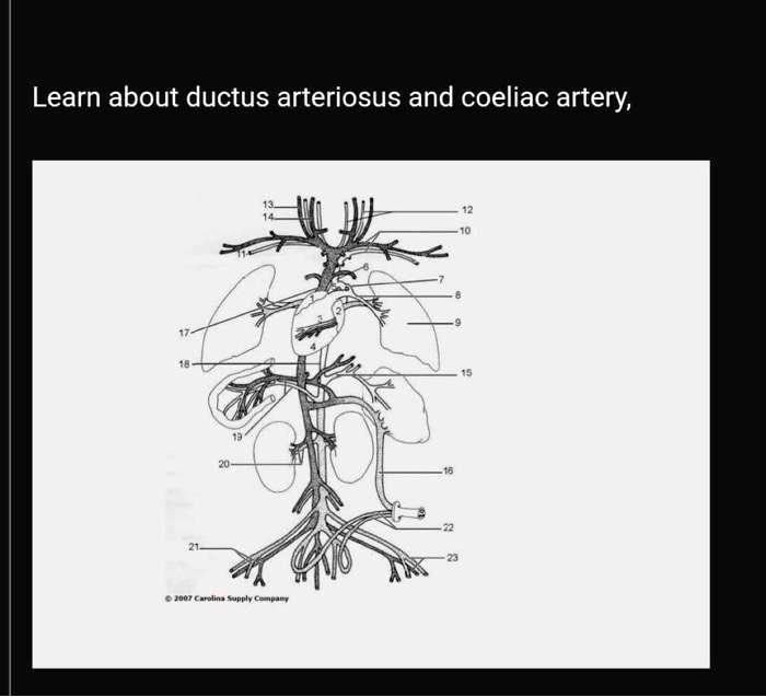Fetal pig dissection. Please help me label the blanks. Learn about ...