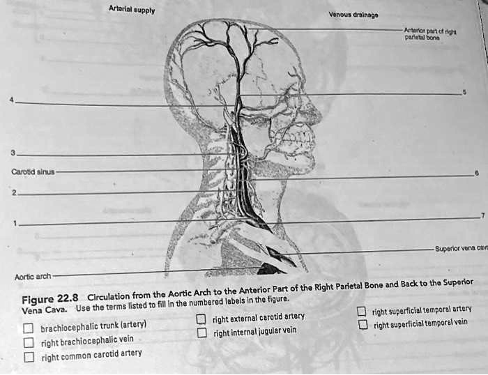 3 Carotid sinus 2. 1 Aortic arch Arterial supply Venous drainage ...