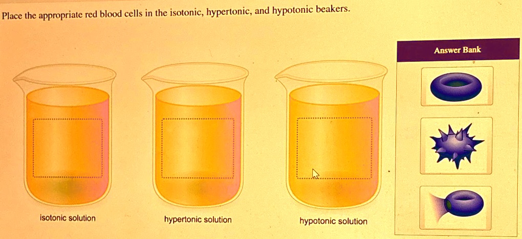 Place the appropriate red blood cells in the isotonic, hypertonic, and ...