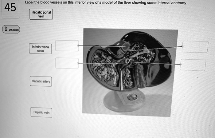 SOLVED: Label the blood vessels on this inferior view of a model of the ...