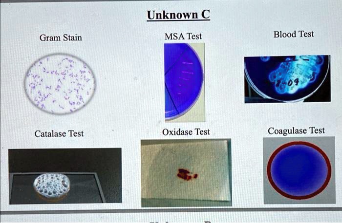 Unknown C Gram Stain MSA Test Blood Test Catalase Test Oxidase Test ...