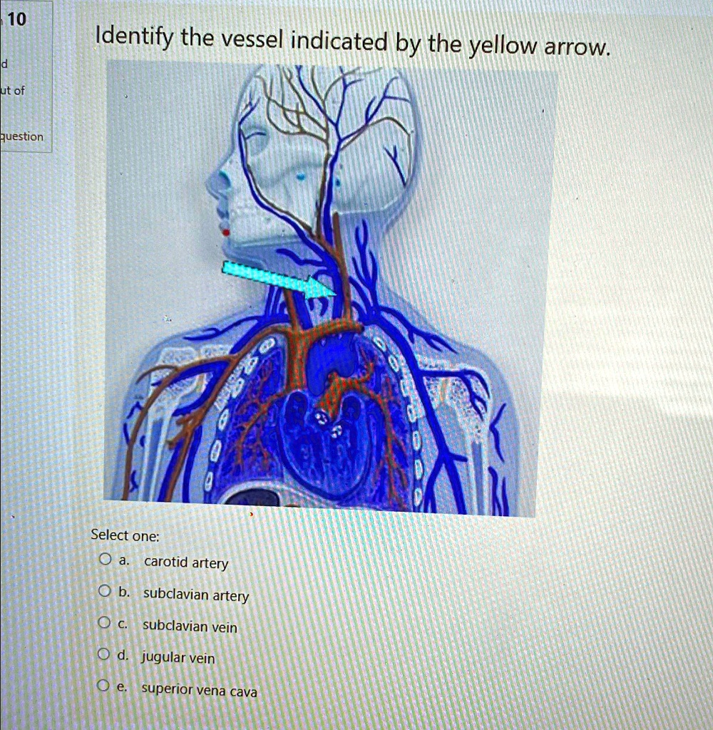 VIDEO solution: 10 Identify the vessel indicated by the yellow arrow. Select one: a. carotid ...