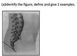 identify the figure define and give 2 examples aidentiiy the figure ...