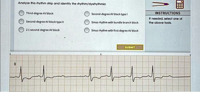 SOLVED: Texts: Analyze this rhythm strip and identify the rhythm ...