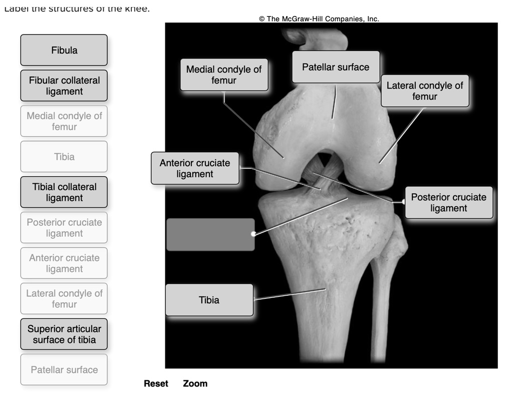 Label the structures of the knee. Fibula Fibular collateral ligament ...