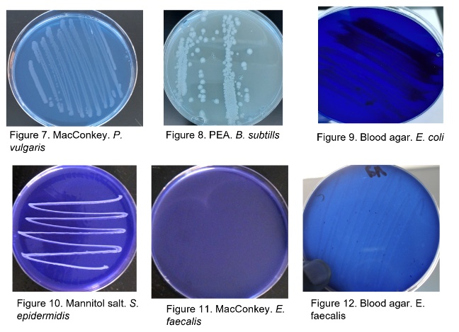 Figure 7. MacConkey. P. vulgaris Figure 8. PEA. B. subtills Figure 9 ...