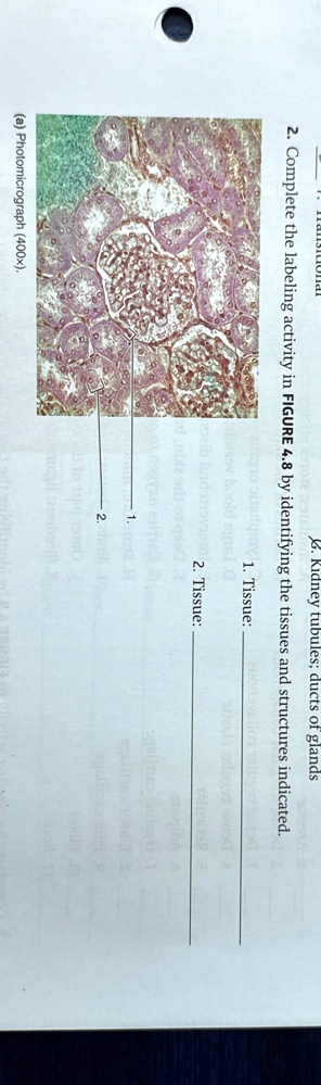 Kidney tubules; ducts of glands 2. Complete the labeling activity in ...