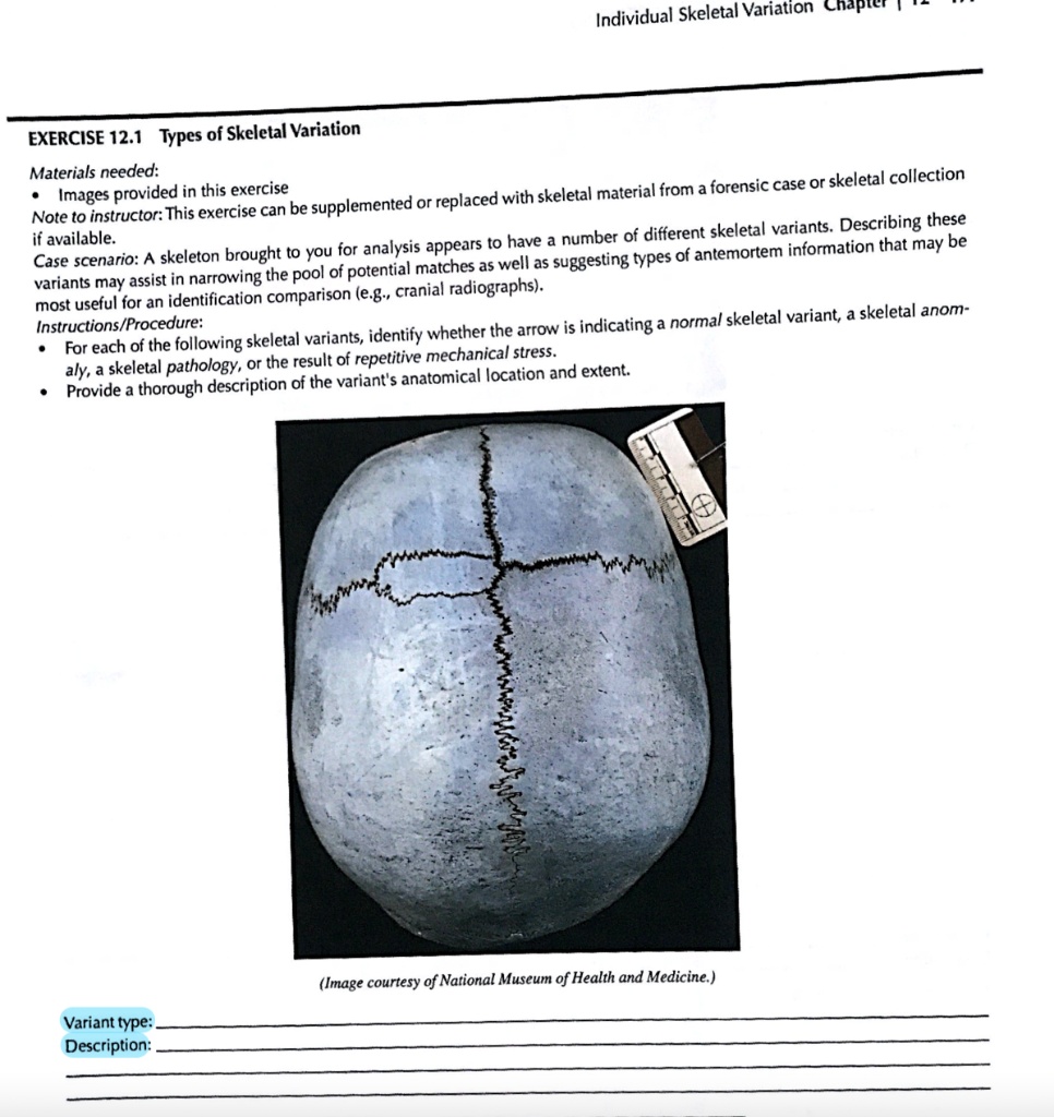 SOLVED: Individual Skeletal Variation Cnapie EXERCISE 12.1 Types of ...