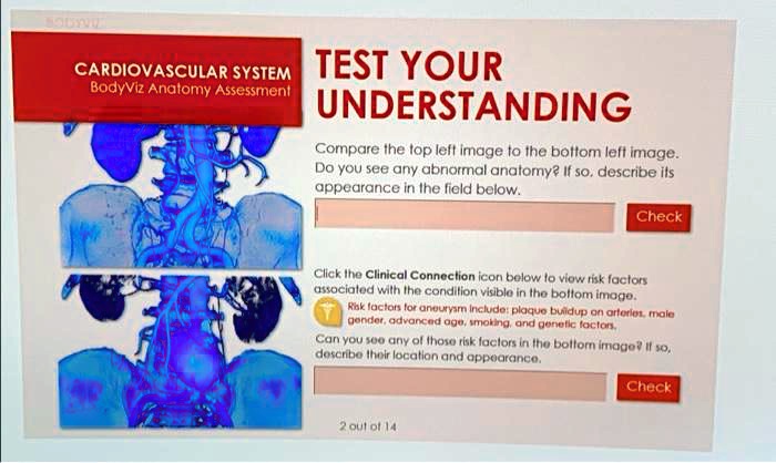 CARDIOVASCULAR SYSTEM TEST YOUR BodyViz Anatomy Assessment ...
