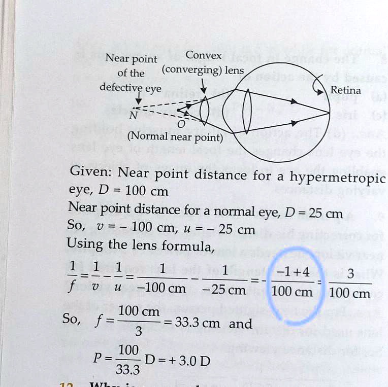 Near point of the defective eye N Convex (converging) lens (Normal near ...