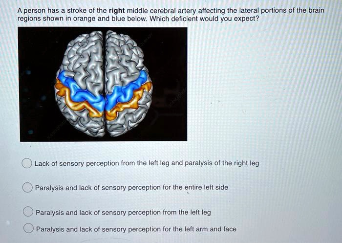 a person has a stroke of the right middle cerebral artery affecting the ...