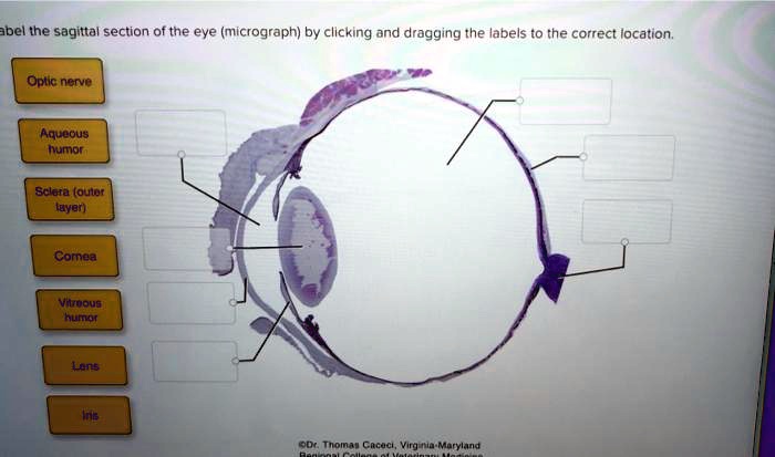 abel the sagittal section of the eye (micrograph) by clicking and ...