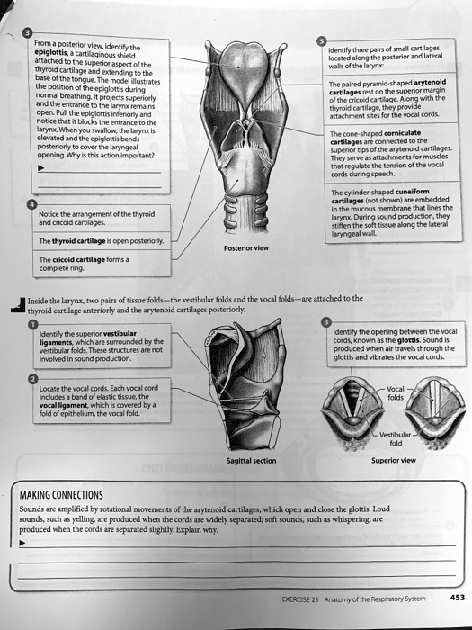 From a posterior view, identify the epiglottis, a cartilaginous shield ...