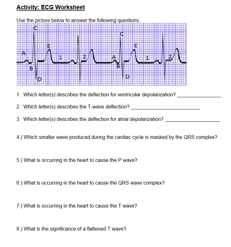 SOLVED: ECG Identification Worksheet Activity: ECG Worksheet Use the ... SOLVED: ECG Identification Worksheet Activity: ECG Worksheet Use the ...