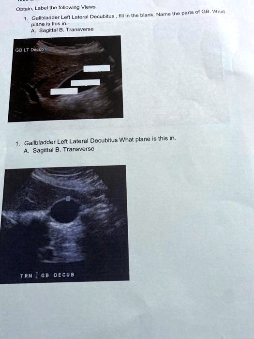 Obtain, Label the following Views 1. Gallbladder Left Lateral Decubitus ...