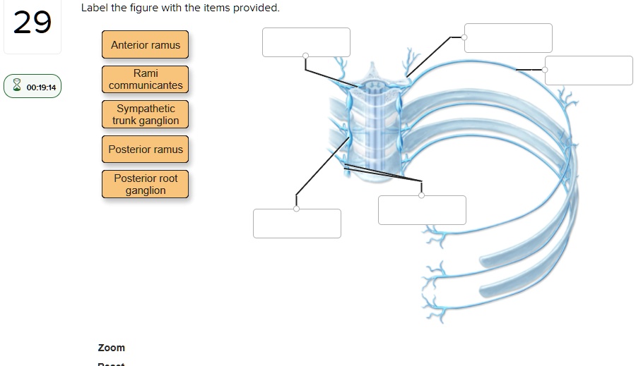 Label the figure with the items provided. 29 Label the figure with the ...