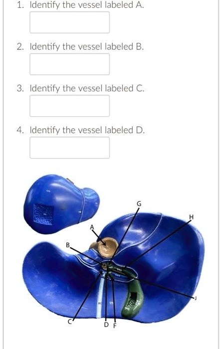 SOLVED: Texts: 1. Identify the vessel labeled A. 2. Identify the vessel ... SOLVED: Texts: 1. Identify the vessel labeled A. 2. Identify the vessel ...