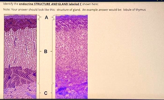 Identify the endocrine STRUCTURE AND GLAND labeled C shown here: Note ...