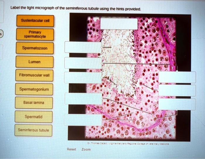 Label the light micrograph of the seminiferous tubule using the hints ...