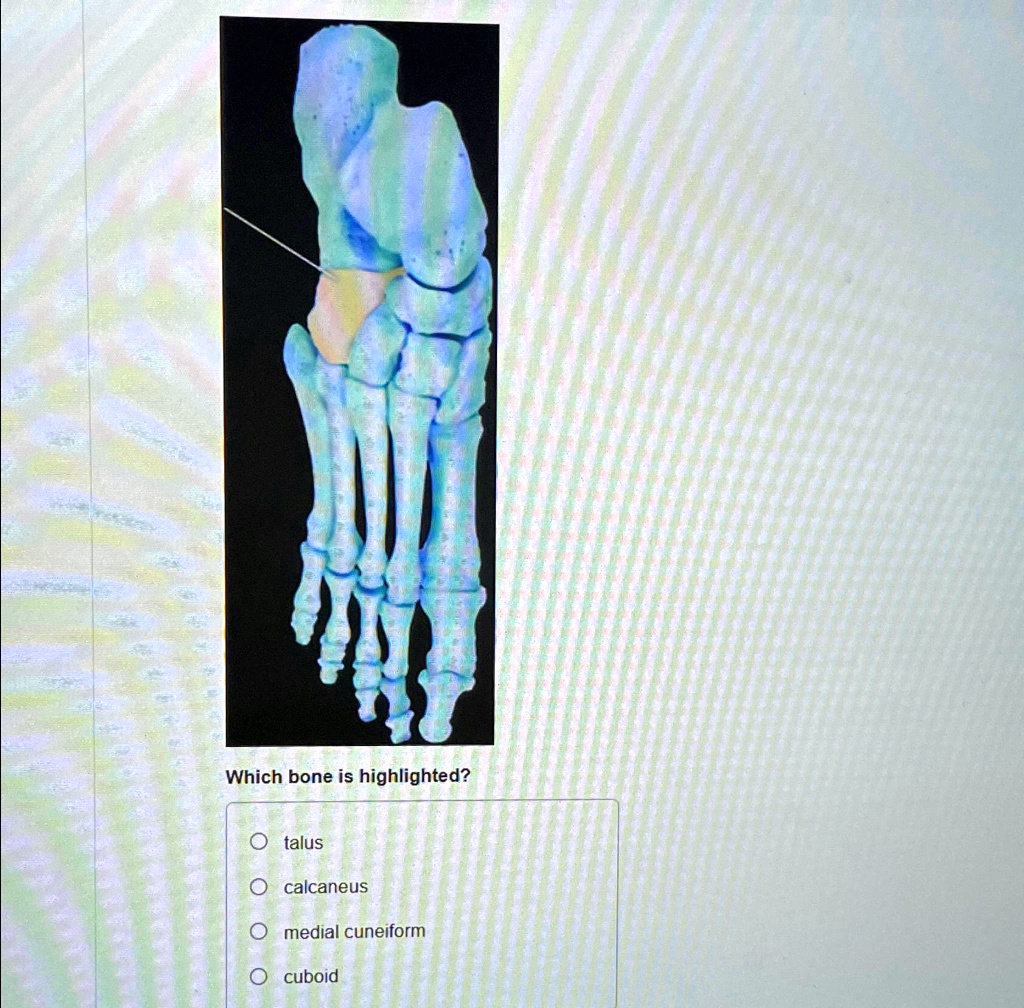 which bone is highlighted talus calcaneus medial cuneiform cuboid which ...