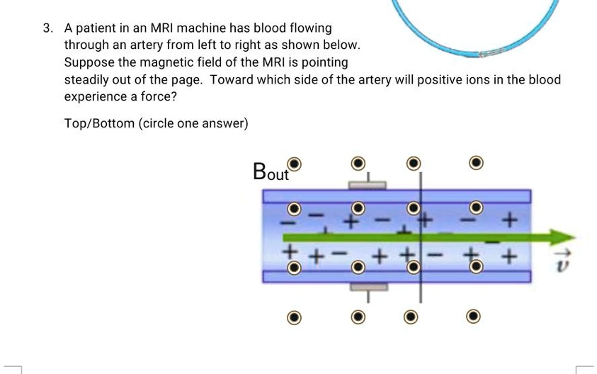 3. A patient in an MRI machine has blood flowing through an artery from ...