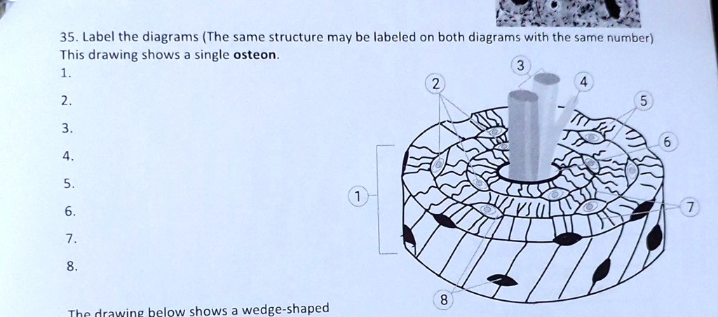 Osteon Diagram Unlabeled