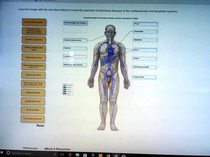 label that image with the microbes listed to review the spectrum of ...