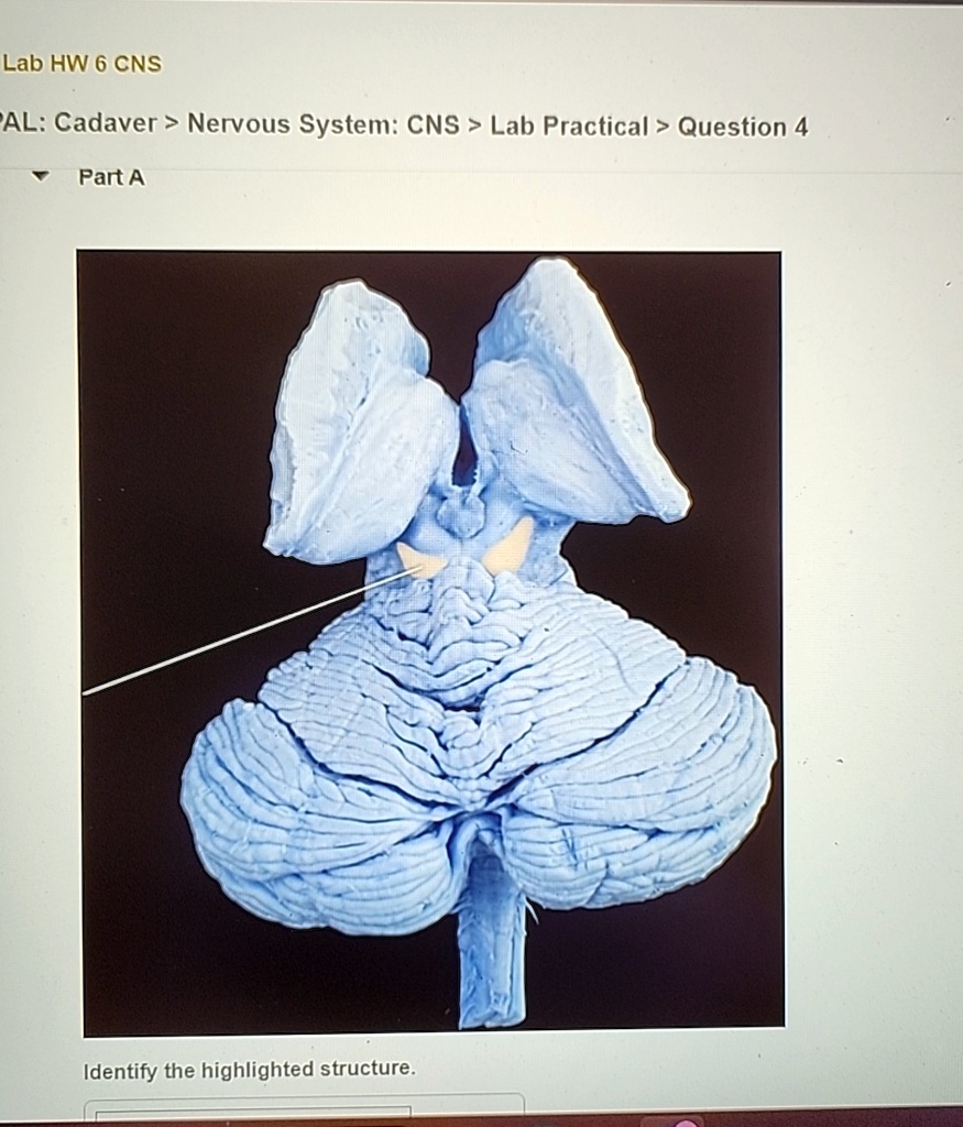 Lab HW 6 CNS PAL: Cadaver > Nervous System: CNS > Lab Practical > Question 4 Part A Identify the ...