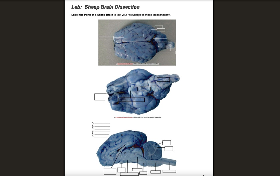 SOLVED: Please answer as soon as possible, thank you. Lab: Sheep Brain ...