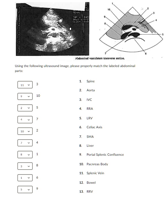 Abdominal vasculature transverse section. Using the following ...