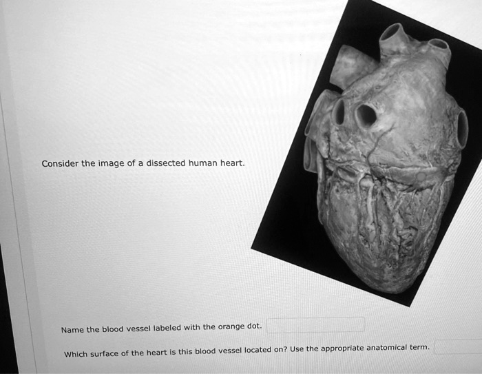 SOLVED:Consider the image of dissected human heart Name the blood ...