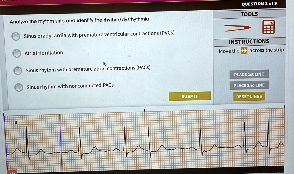 question 2 of 9 tools analyze the rhythm strip and identify the ...