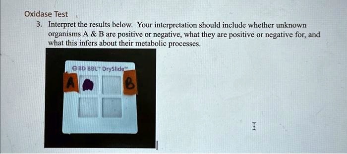 SOLVED: Oxidase Test 3. Interpret the results below. Your ...