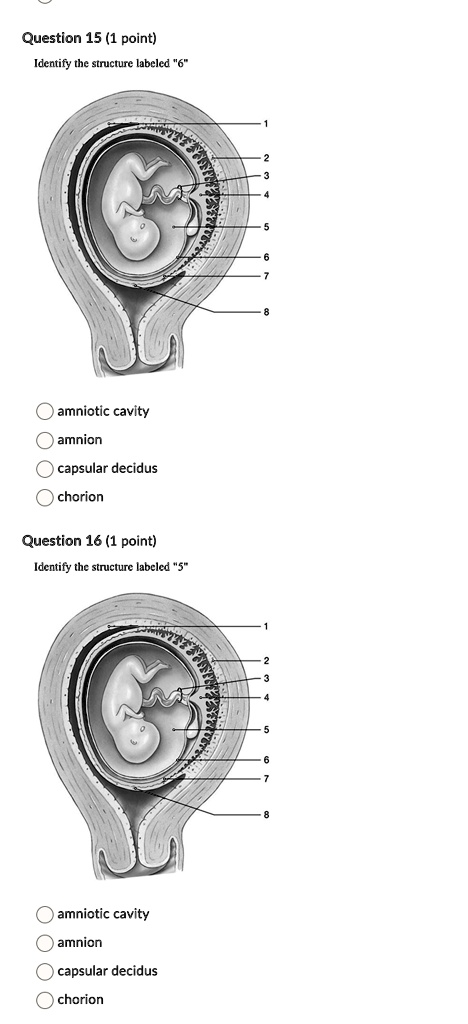 Question 15 (1 point) Identify the structure labeled "6" amniotic ...