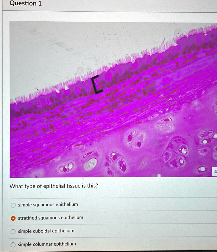Question 1 What type of epithelial tissue is this? simple squamous ...