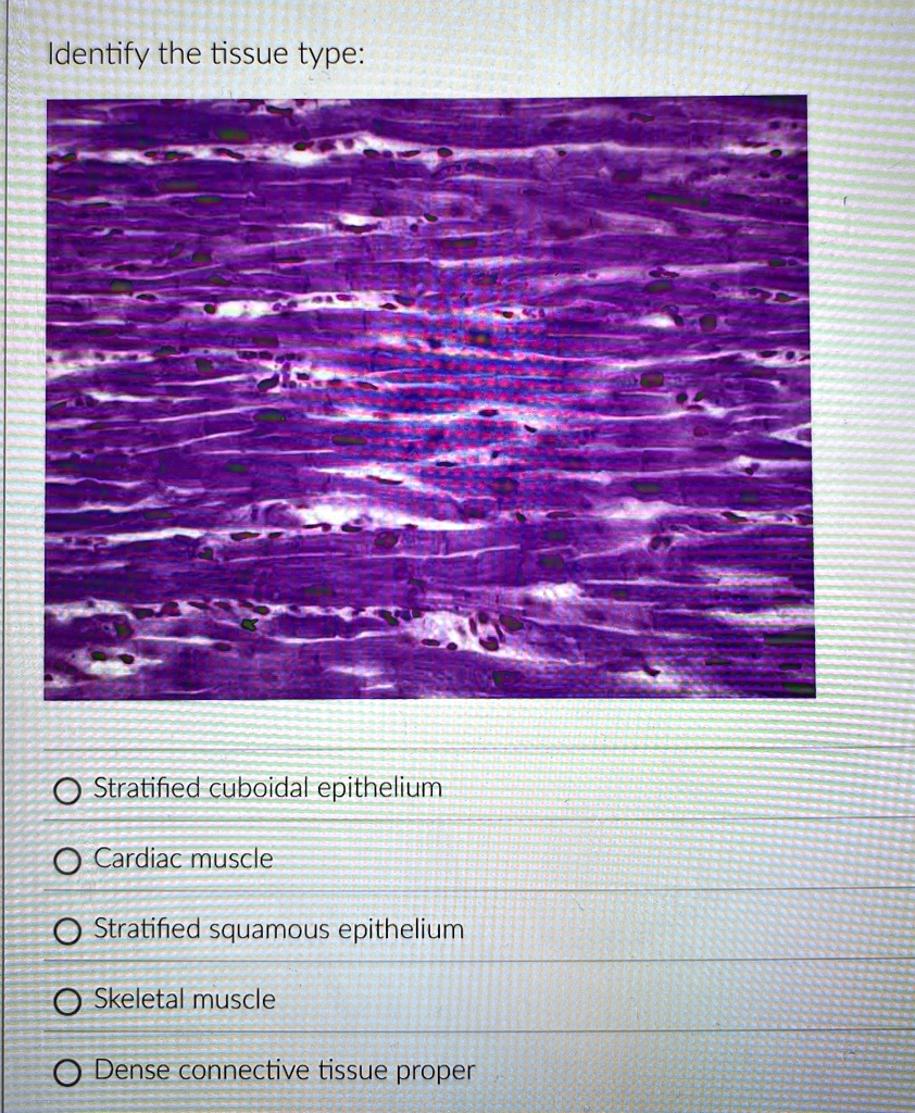 identify the tissue type o stratified cuboidal epithelium cardiac ...