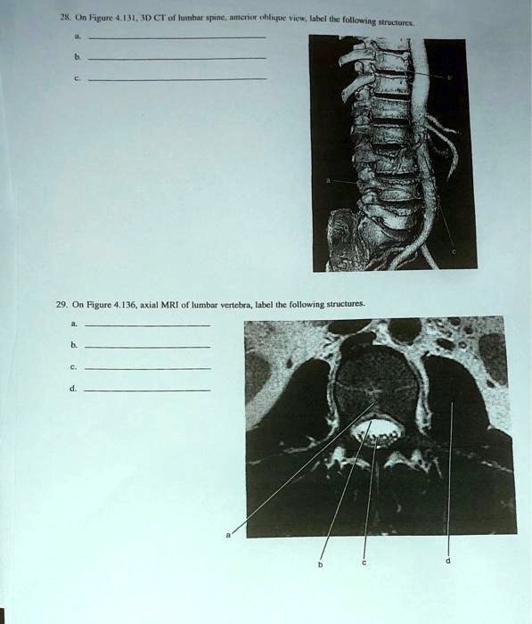 SOLVED: On Figure 4.136, axial MRI of lumbar vertebra, label the ...