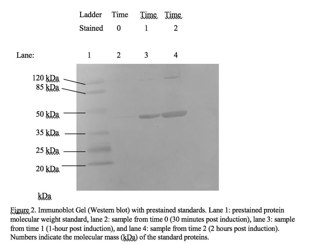 SOLVED: Ladder Time Time Line Stained Lane: 2 3 120 kDa 85 kDa 50 kDa ...