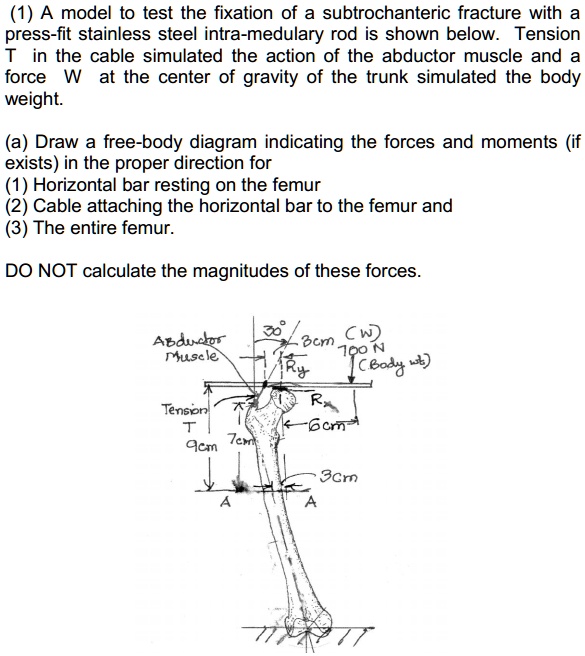 SOLVED: A model to test the fixation of a subtrochanteric fracture with ...