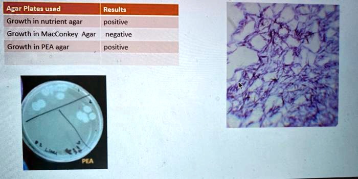 SOLVED: Agar Plates used Results Growth in nutrient agar positive ...