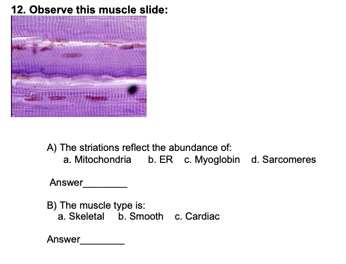 SOLVED: 12. Observe this muscle slide: A) The striations reflect the ...
