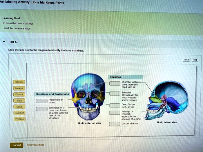 Solved Art Labeling Activity Bone Markings Humerus Dr - vrogue.co Solved Art Labeling Activity Bone Markings Humerus Dr - vrogue.co